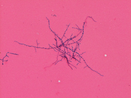 Microbiology Case Study – Lablogatory