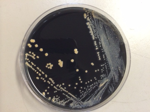 Microbiology Case Study – Lablogatory