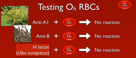 The Bombay Phenotype – Lablogatory