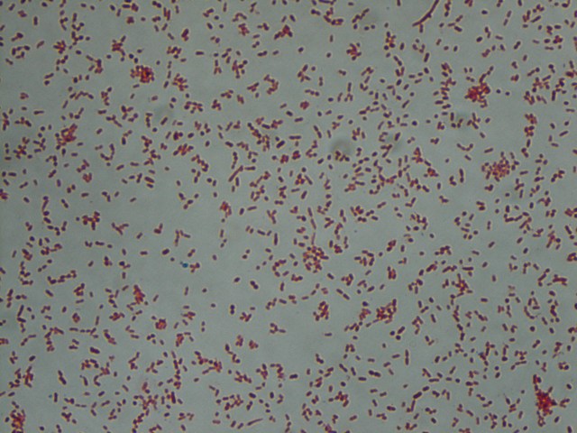 Klebsiella Negative Stain