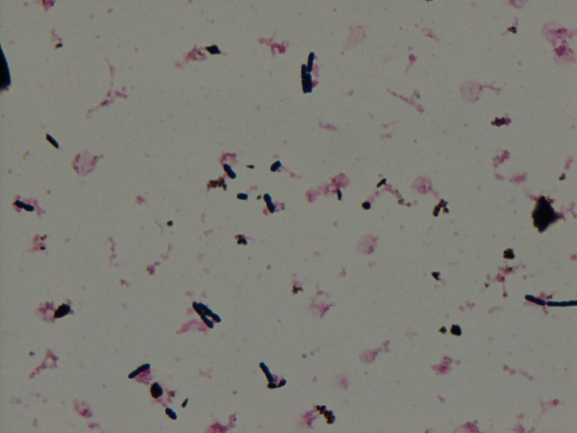 Microbiology Case Study: 58 Year Old Male with Right Upper Quadrant ...