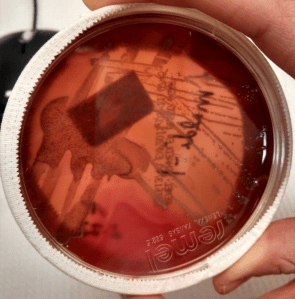 Microbiology Case Study: 58 Year Old Male with Right Upper Quadrant ...