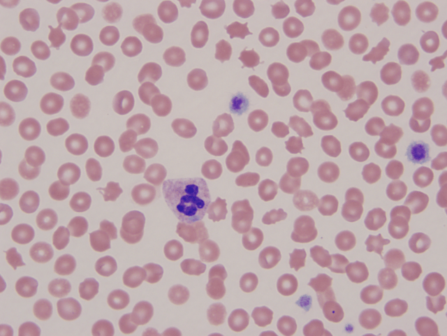 Rare Giant Platelets Explore The Secrets Of The Feathered Edge