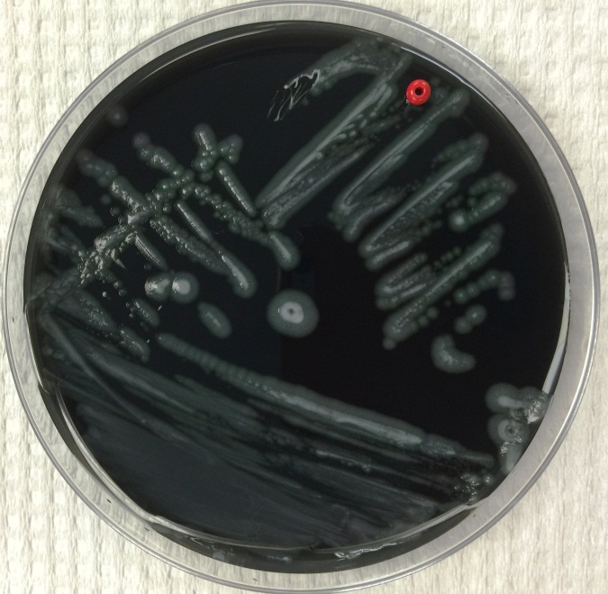 Microbiology Case Study–A Very Sick 51 Year Old Man – Lablogatory