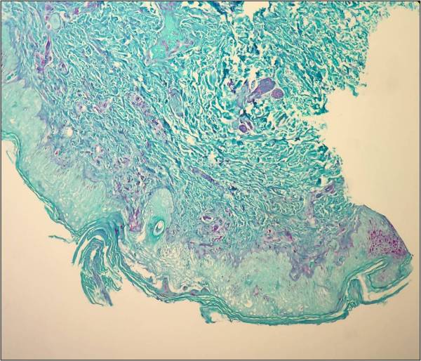 Fusarium – Lablogatory