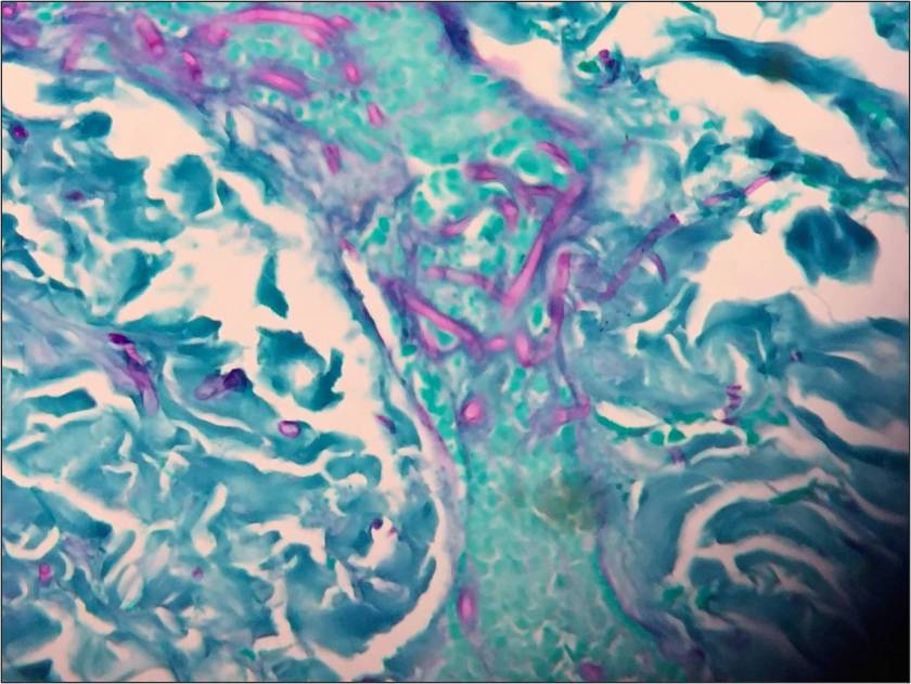 Fusarium – Lablogatory