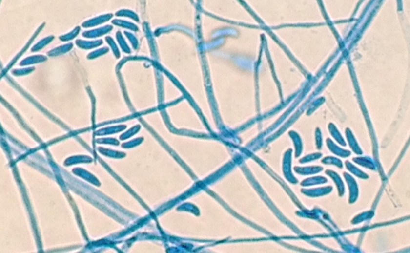Fusarium – Lablogatory