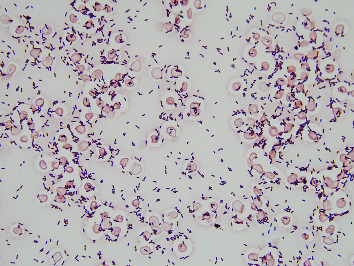 Microbiology Case Study: A Two-Week-Old Infant with Fever and Fussiness ...