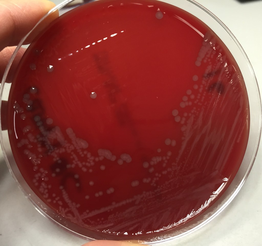 January 12, 2016 – Lablogatory