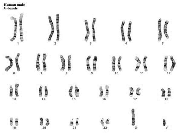 Chromosome Structure, Staining, and Naming – Lablogatory
