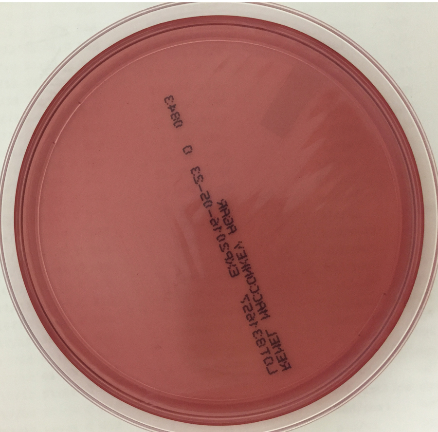 Microbiology Case Study: 8 Day Old with Meningitis – Lablogatory