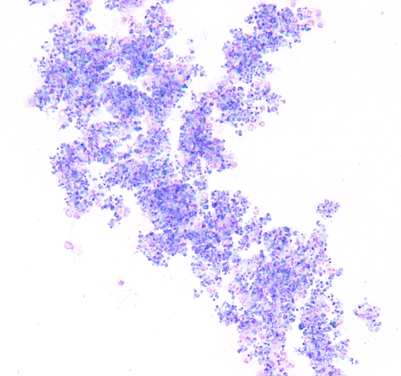 Microbiology Case Study: A 26 Year Old Female with Peri-partum Fever ...