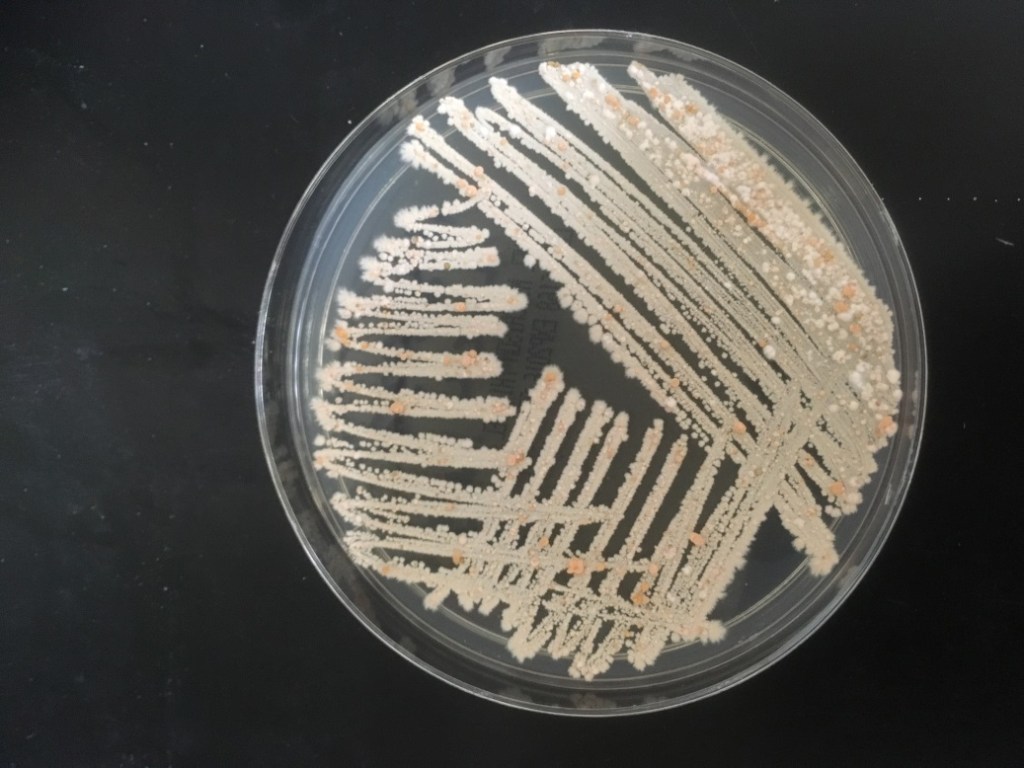 Microbiology Case Study: A 60 Year Old Woman with Increasingly Frequent ...