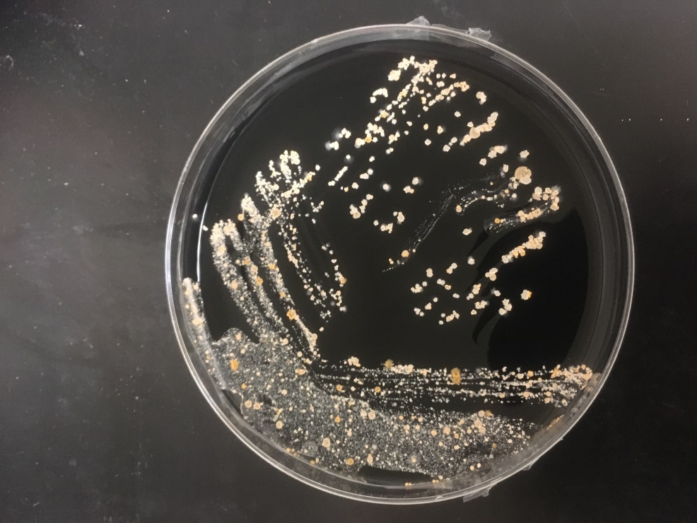 Microbiology Case Study: A 60 Year Old Woman with Increasingly Frequent ...
