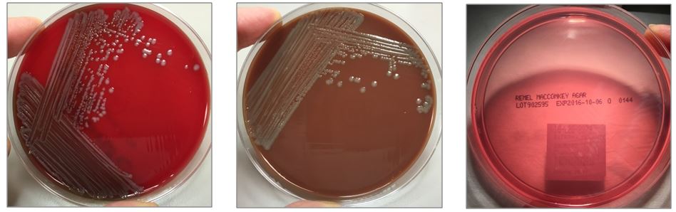 Microbiology Case Study: 3-year-old Female with Facial Wound – Lablogatory