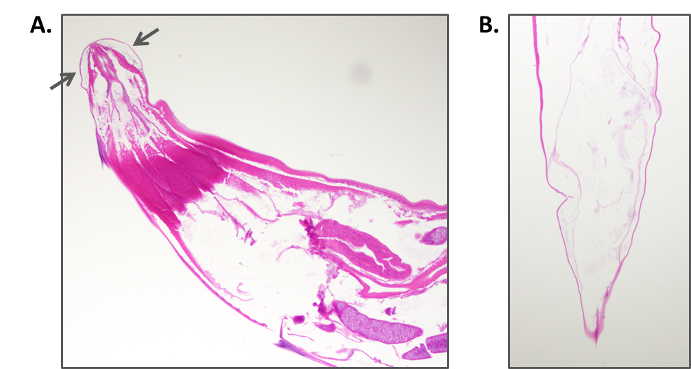 Microbiology Case Study: 12 Year Old with Abdominal Pain – Lablogatory