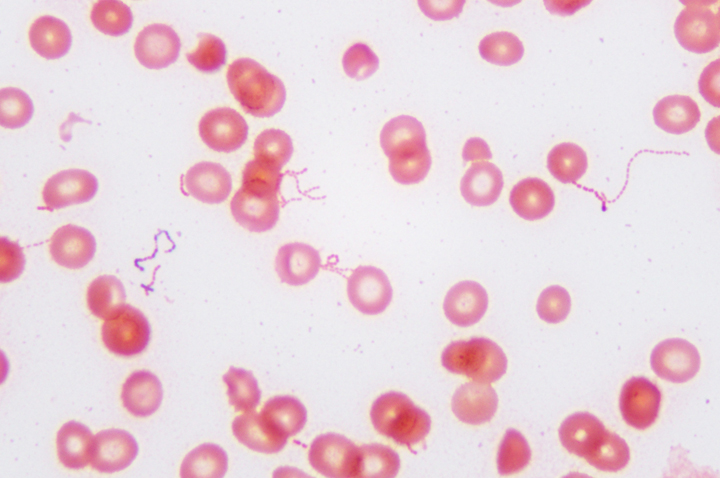 Microbiology Case Study: 15 Year Old with Bacteremia – Lablogatory