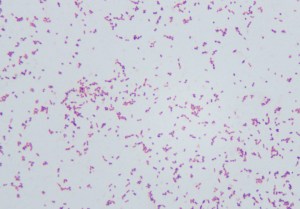 Microbiology Case Study: 15 Year Old with Bacteremia – Lablogatory