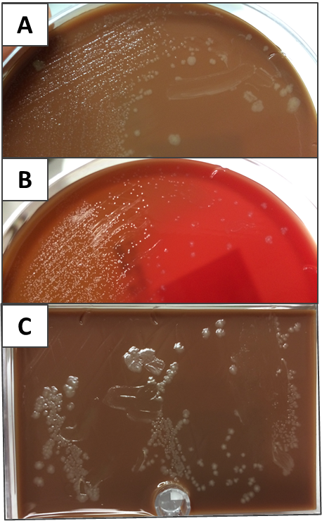 Microbiology Case Study: A 4 Day Old with Eye Drainage – Lablogatory