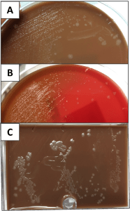 Microbiology Case Study: A 4 Day Old with Eye Drainage – Lablogatory