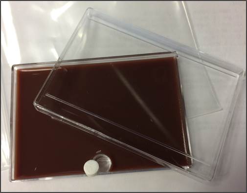 Microbiology Case Study: A 4 Day Old with Eye Drainage – Lablogatory