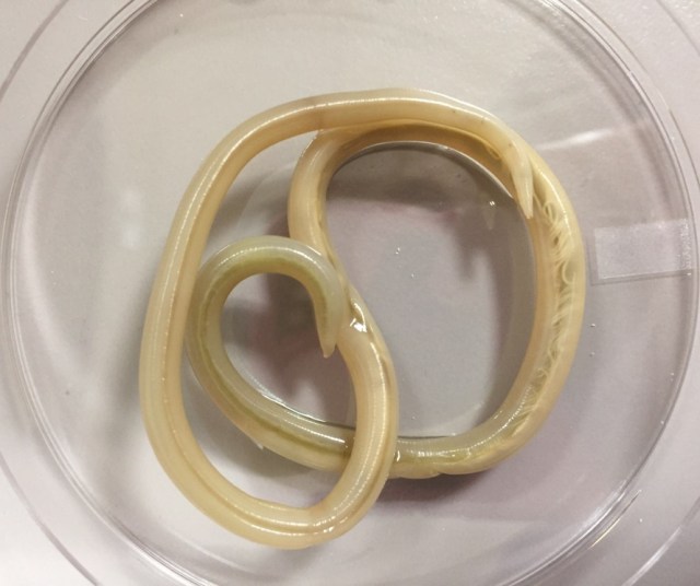 Ascaris Lumbricoides Male And Female