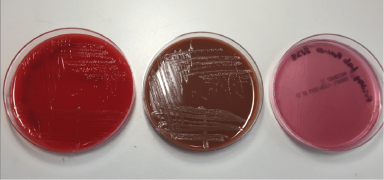 Microbiology Case Study: A 34 Year Old Female with Nausea, Vomiting ...