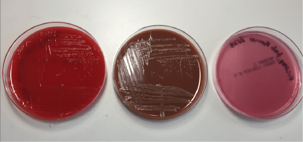 Microbiology Case Study: A 34 Year Old Female with Nausea, Vomiting ...