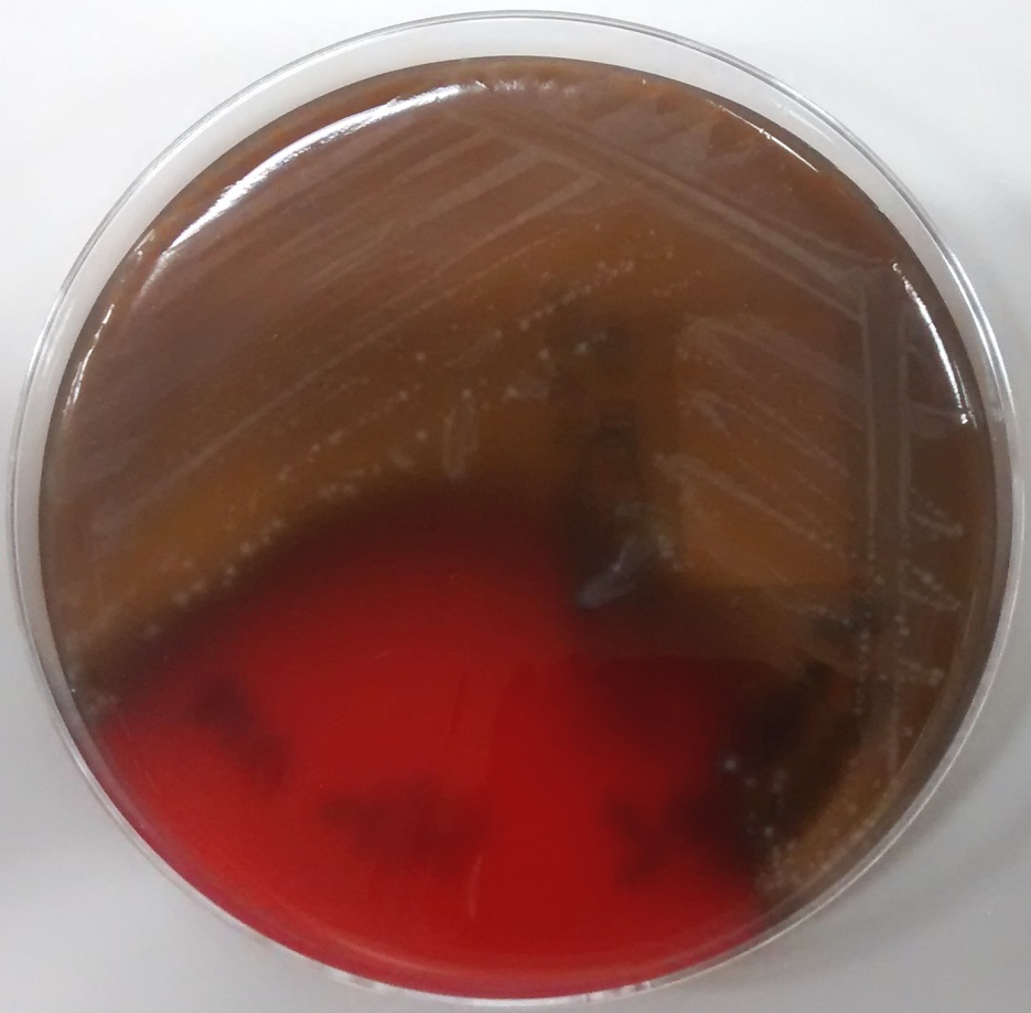 Microbiology Case Study: A 75-Year-Old Man with Polymicrobial ...
