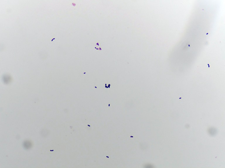 Microbiology Case Study: 6 Year Old Male with Meningitis – Lablogatory