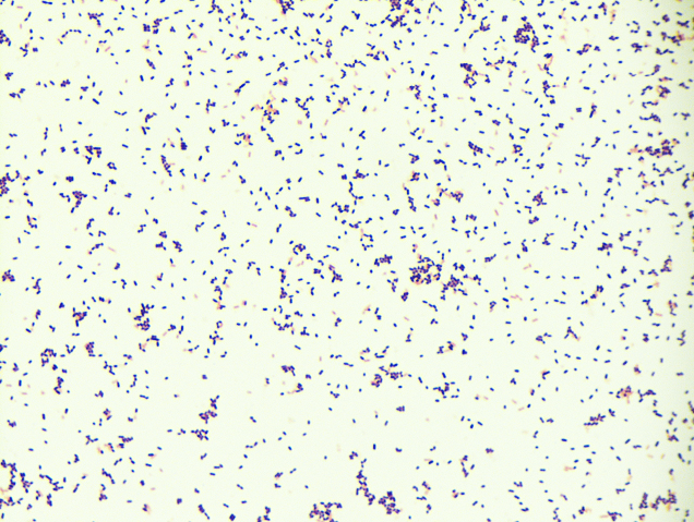 Microbiology Case Study: An 88 Year Old Male with Headache – Lablogatory