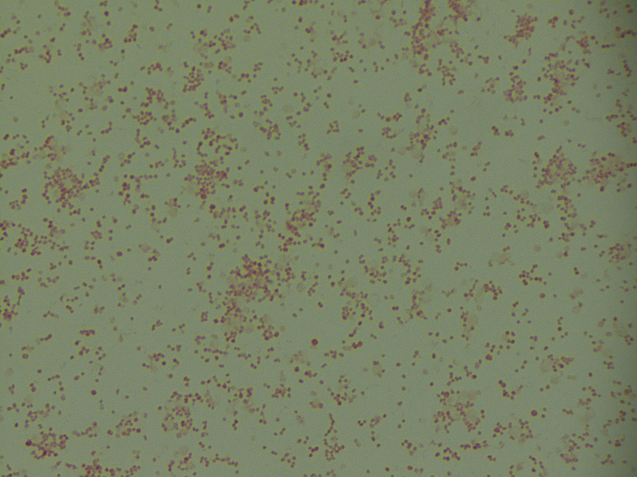 Microbiology Case Study: A 28 Year Old Female with Perirectal Abscess ...