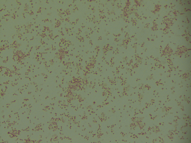 Microbiology Case Study: A 28 Year Old Female with Perirectal Abscess ...