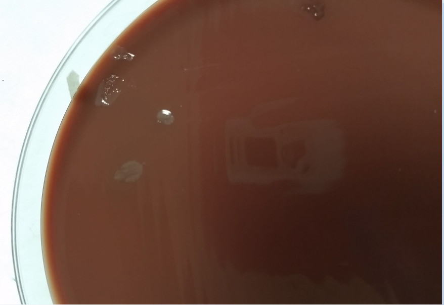 Microbiology Case Study: A 28 Year Old Female with Perirectal Abscess ...