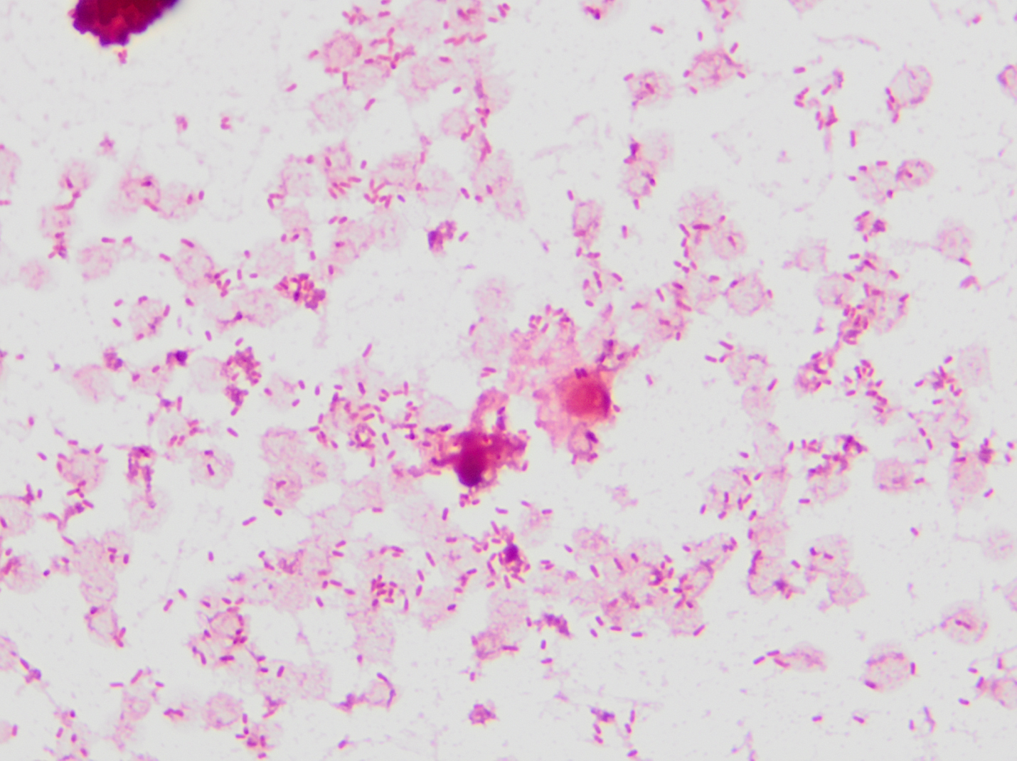 Microbiology Case Study: A 36 Year Old Man with Symptoms of Bowel ...