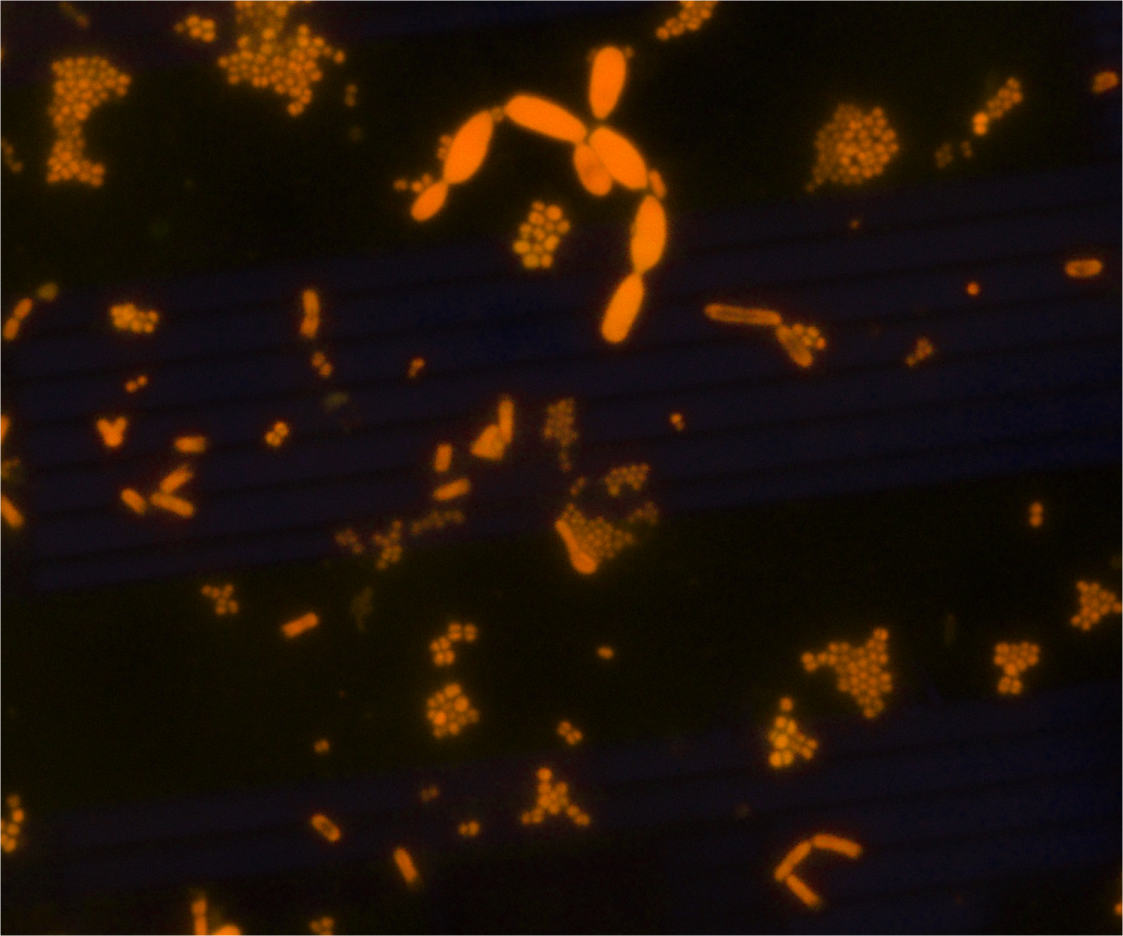 Tissue is the Issue: Direct Observation of Microorganisms (part 2) – Lablogatory