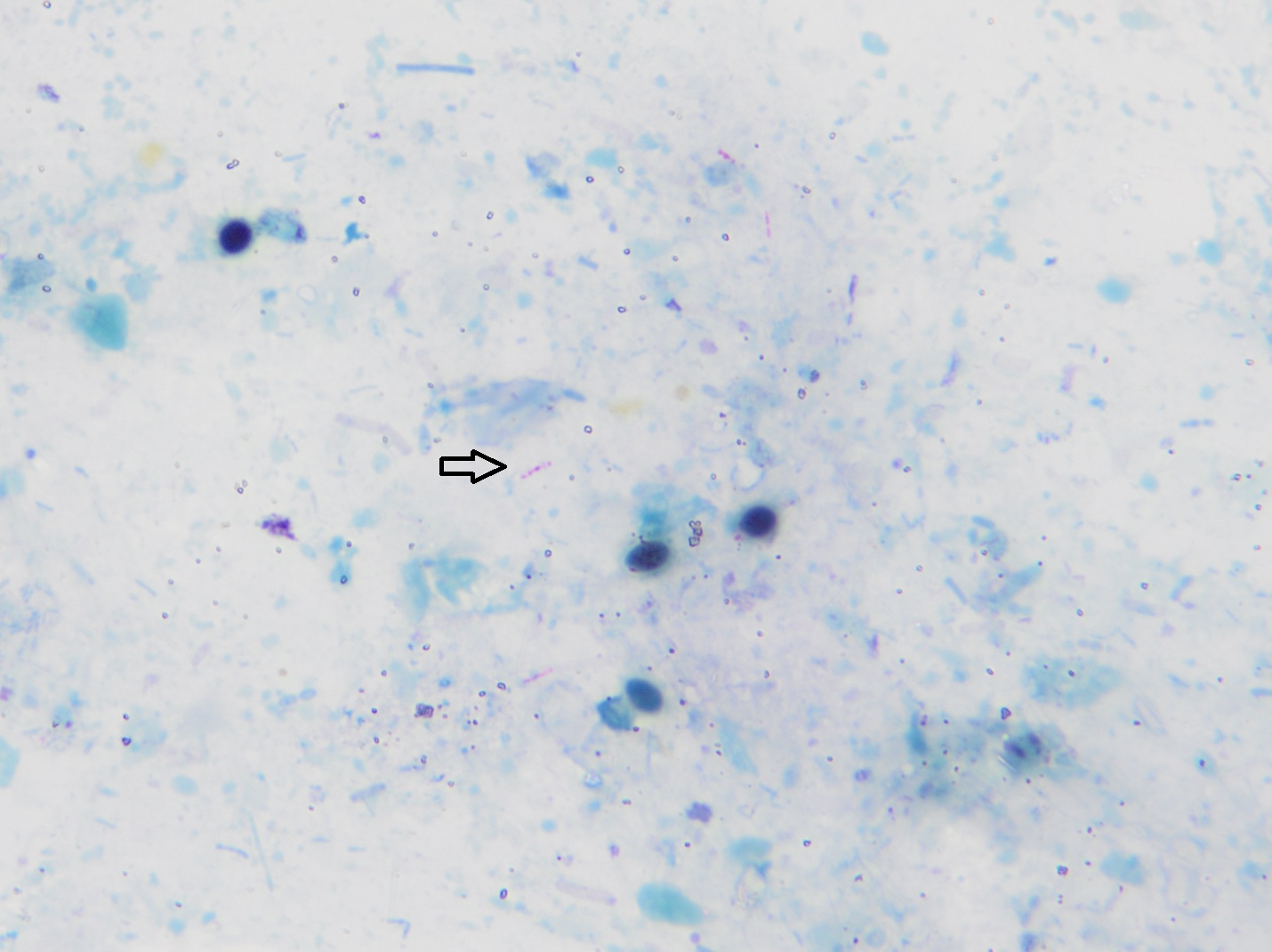 Microbiology Case Study: A 27 Year Old Male with Unintended Weight Loss ...
