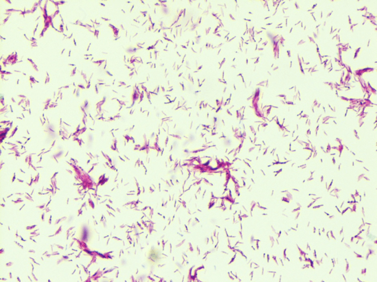 Microbiology Case Study: A 62 Year Old Male with Productive Cough ...