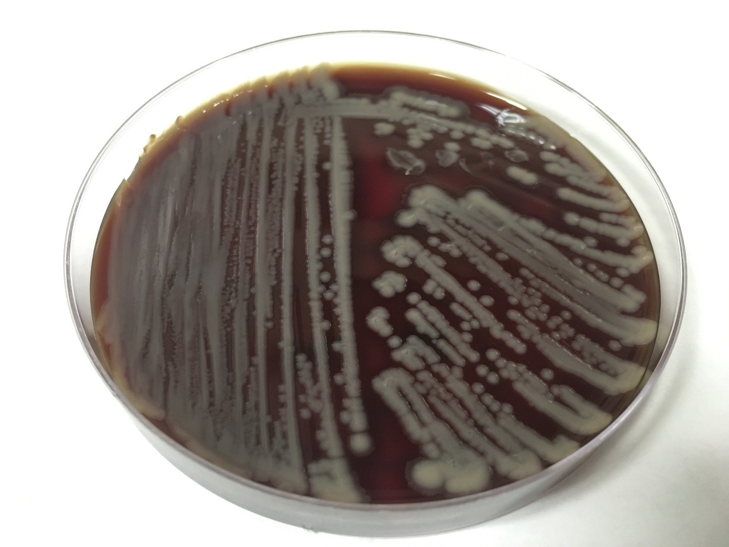 Microbiology Case Study: A Young Adult with A Skin Lesion – Lablogatory