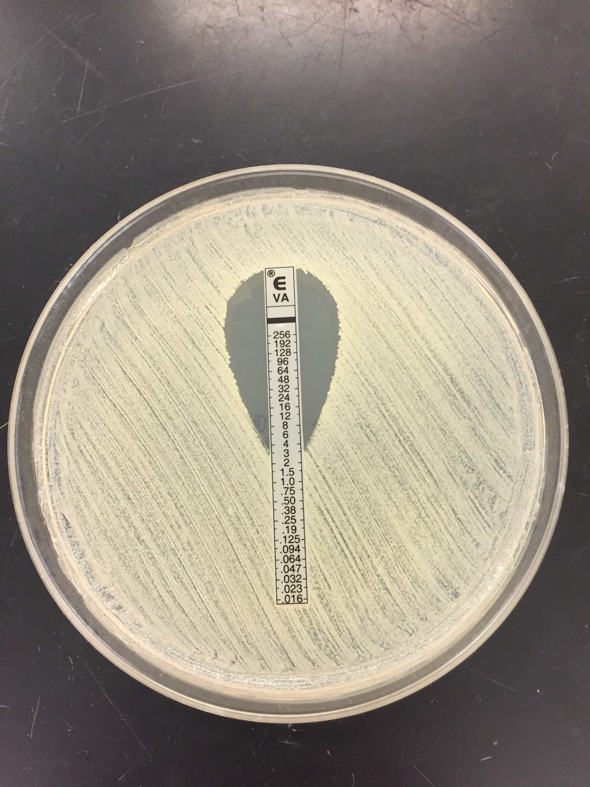 Microbiology Case Study: A 37 Year Old Man with Endocarditis – Lablogatory