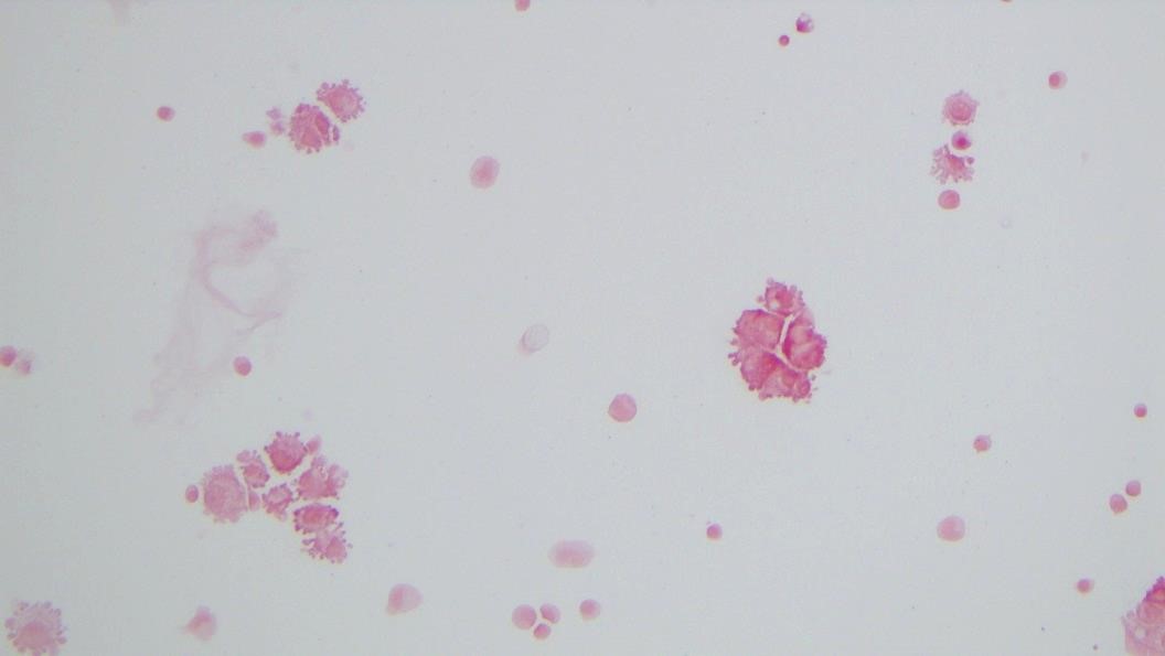 Gram Stain Examination – Beyond Infectious Organisms – Lablogatory