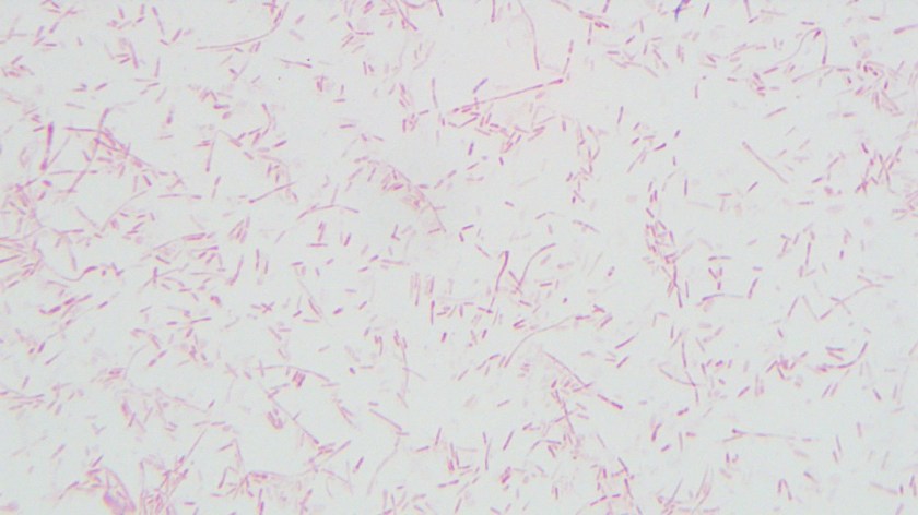 Microbiology Case Study: A 54 Year Old Male with Shortness of Breath ...