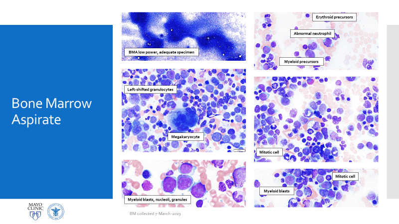 I Had a Blast – Lablogatory