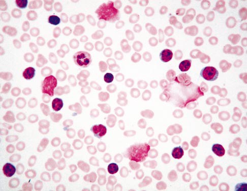 differential – Lablogatory
