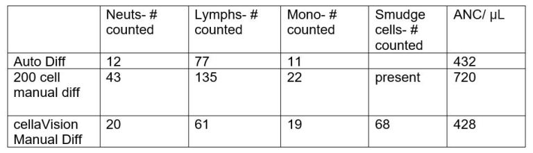 Smudge Cells: Artifacts or Clinically Significant? – Lablogatory