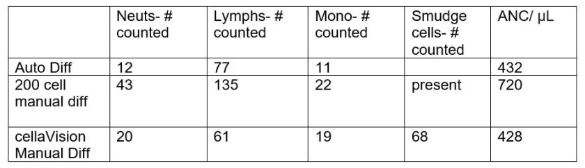 Smudge Cells: Artifacts or Clinically Significant? – Lablogatory