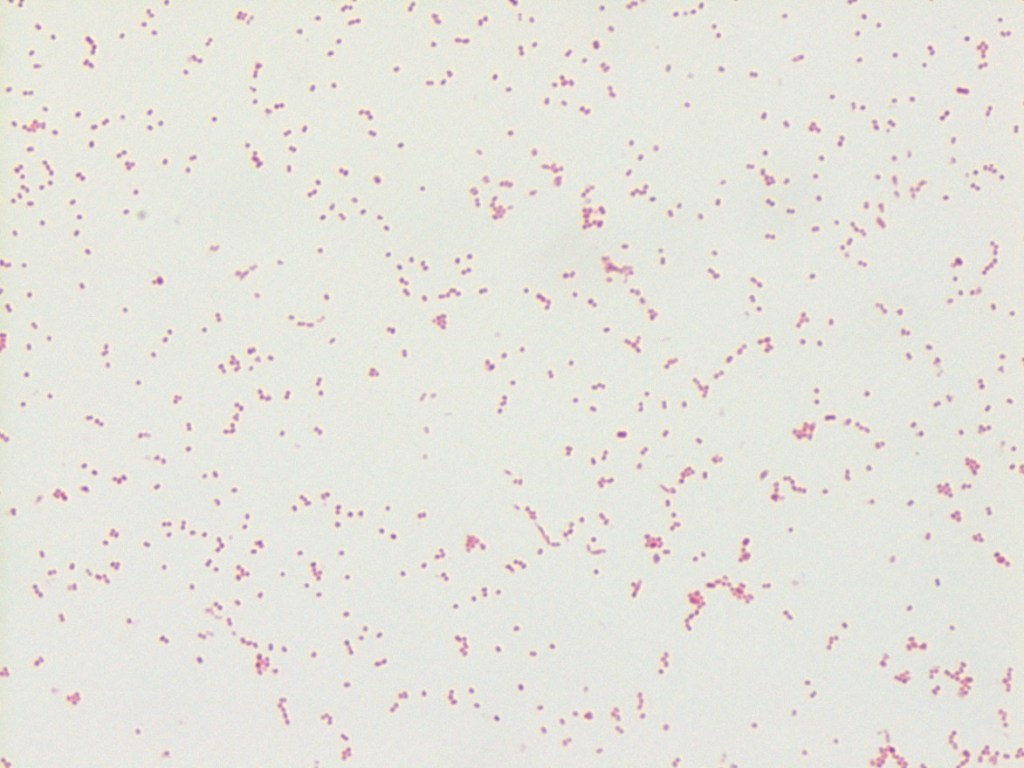 Microbiology Case Study: A 57 Year Old Man with Fever – Lablogatory