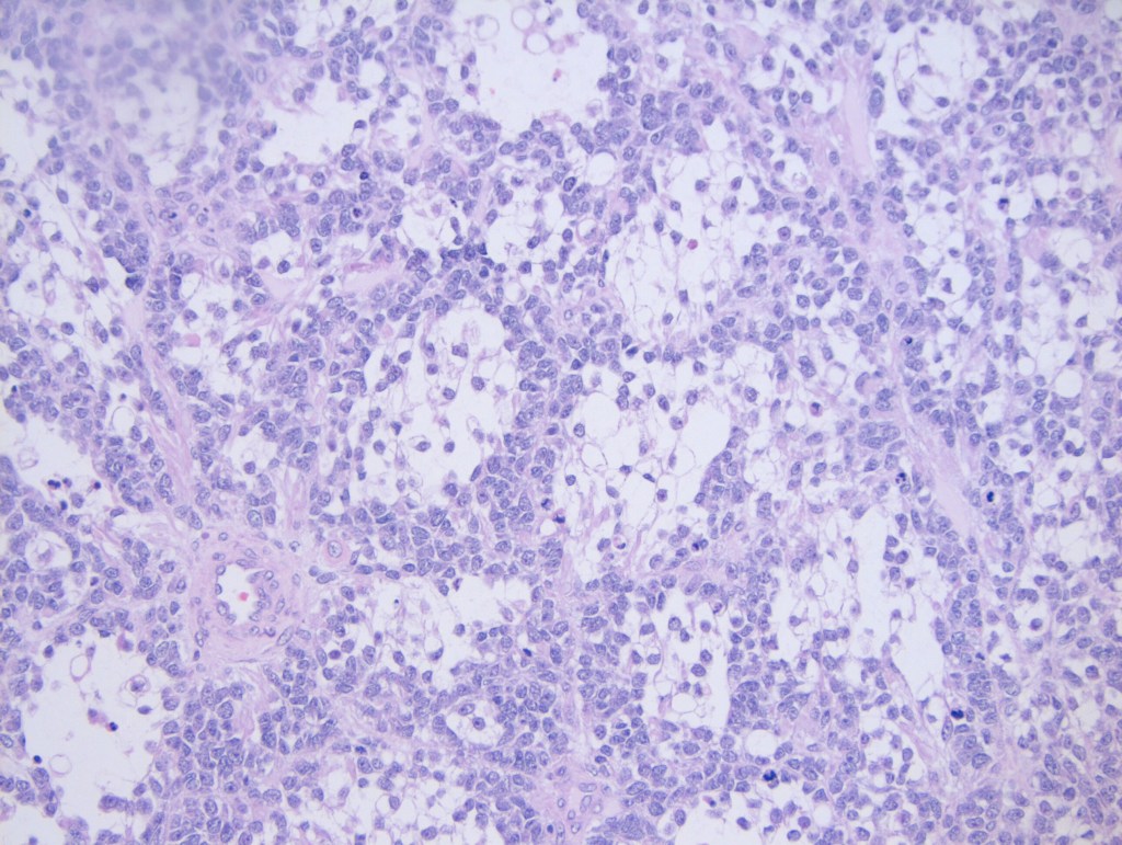 rhabdo2 – Lablogatory