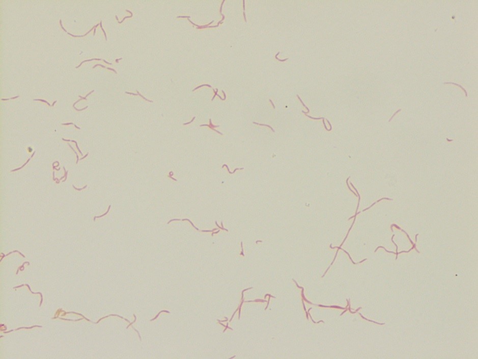 Microbiology Case Study: A 73 Year Old with Bacteremia Caused by an ...