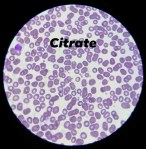 platelets – Lablogatory